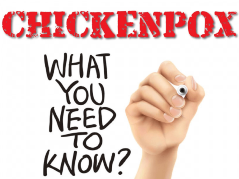Chickenpox: What You Need to Know - Novomedi